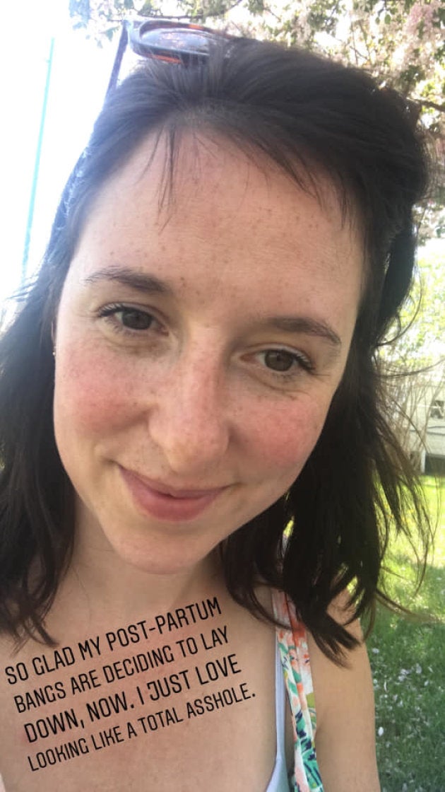 출산 후 엄마의 탈모 현상을 보여주는 솔직한 사진들 | 허프포스트코리아 LIFE