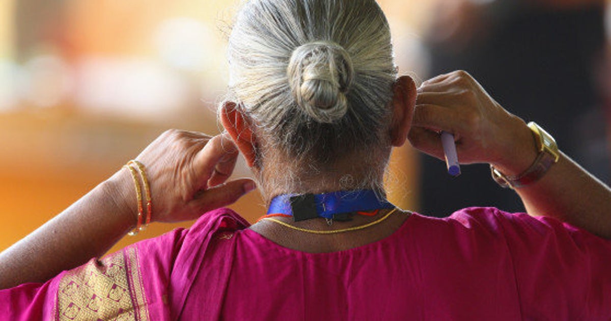 BAHA Is Emerging As Best Treatment For Single Side Deafness In India ...