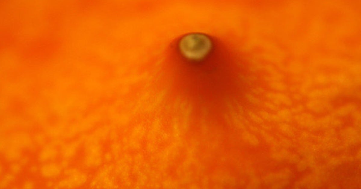 This Video Of A Girl Popping A Huge Zit Will Freak You Out Huffpost News