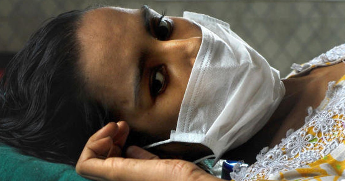 We Need To Fight TB Together, End Social Stigma | HuffPost News