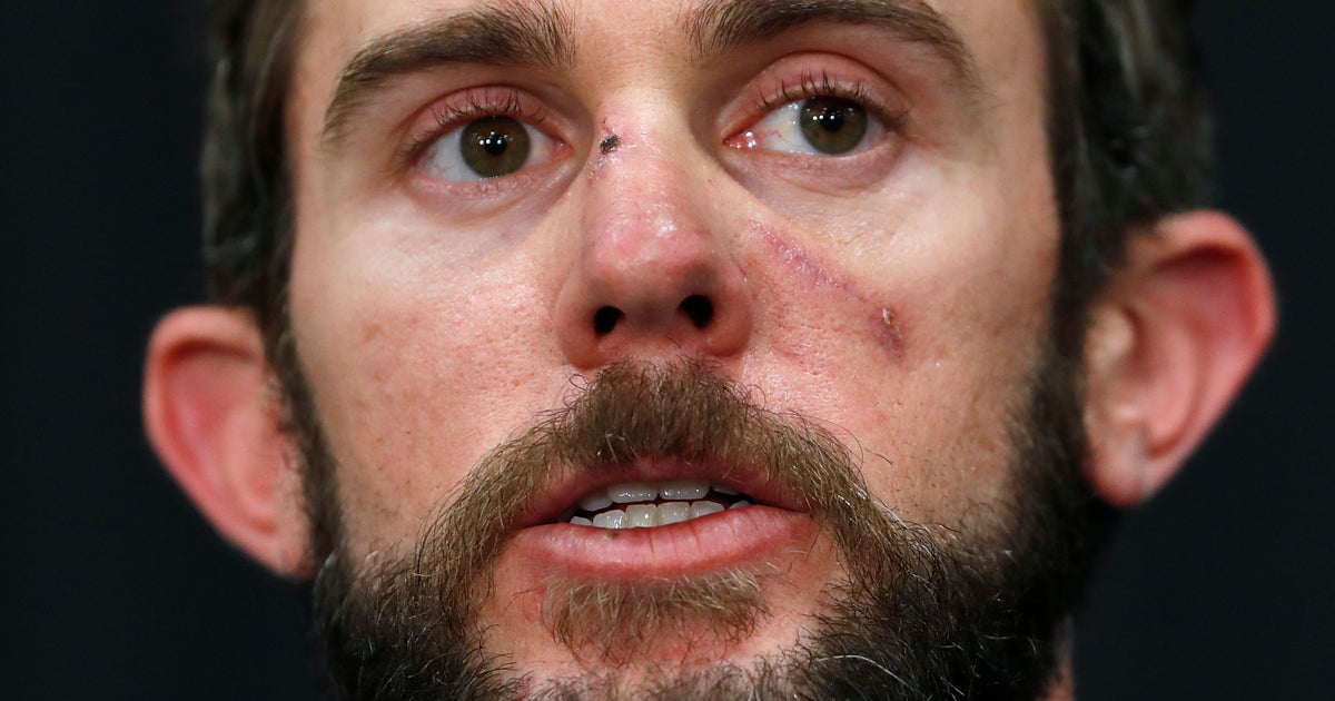 'Puny' Runner Attacked By Colorado Mountain Lion Reveals He Killed ...