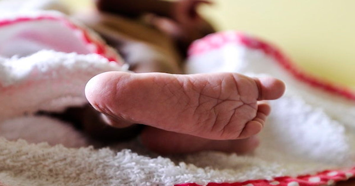 Badass Moms Show Off Their C Section Scars Huffpost Uk News