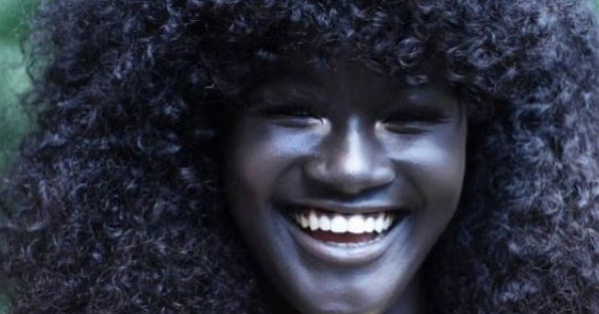 Se burlaban de ella por el color de su piel y ahora es modelo | El HuffPost