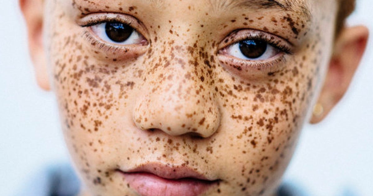 Esta fotógrafa explora la hermosa diversidad de los negros pelirrojos ...