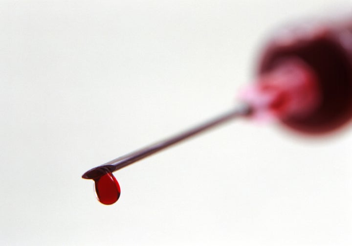 California AIDS Patients: Profile Has Changed Over The Last 30 Years ...