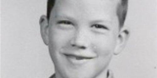 Howard Dully Before After