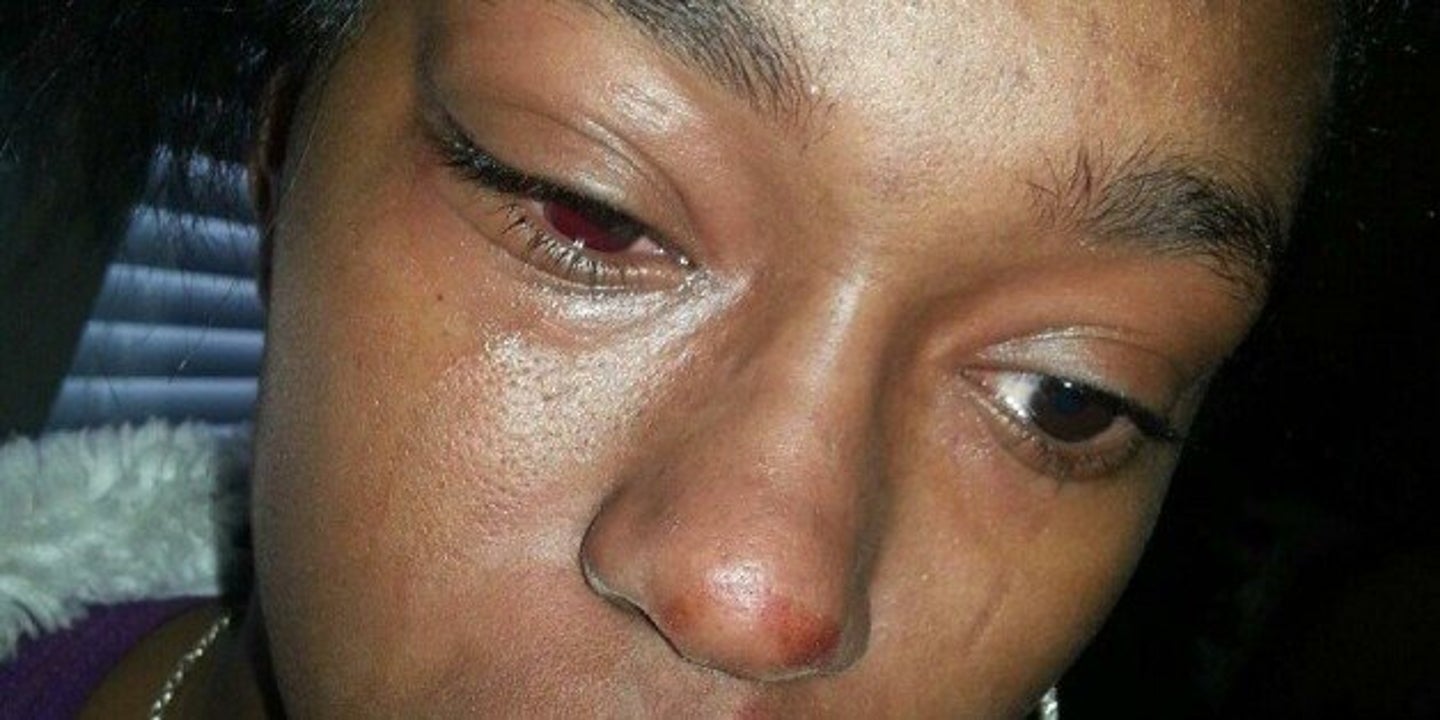 Sharkeisha Fight Victim ShaMichael Manuel Speaks Out (VIDEO) | HuffPost ...