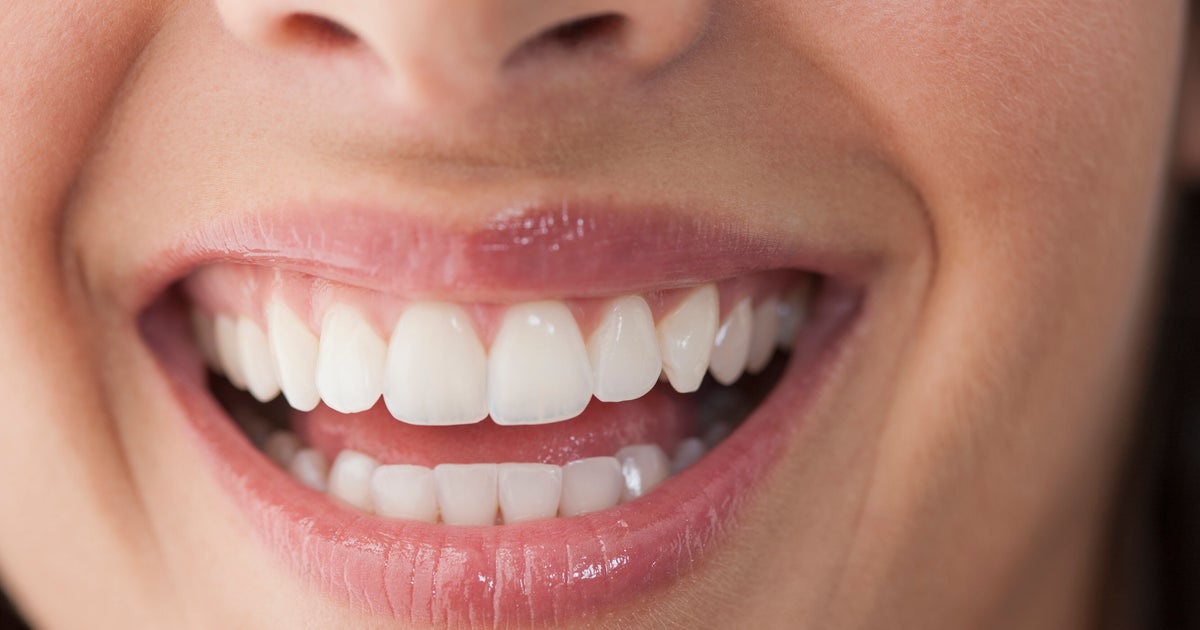 Histoire de dents | HuffPost Vivre