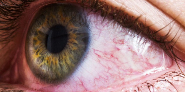 8 conseils pour soulager vos symptômes d'allergies si vous portez des ...