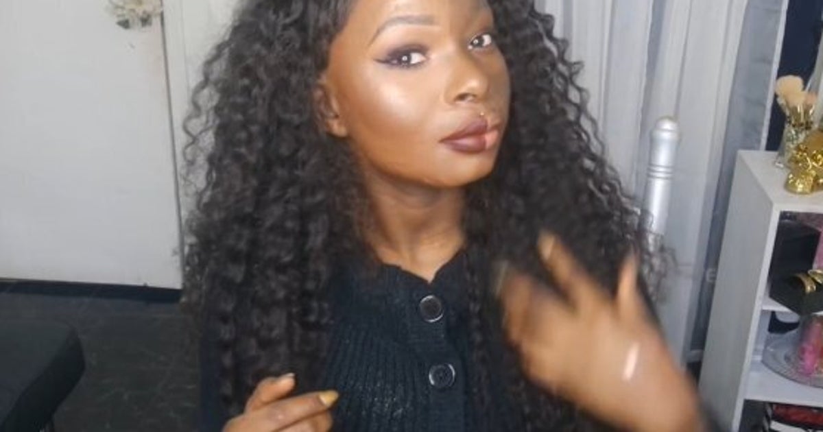 Brûlée au visage, elle utilise un tutoriel maquillage pour faire passer ...