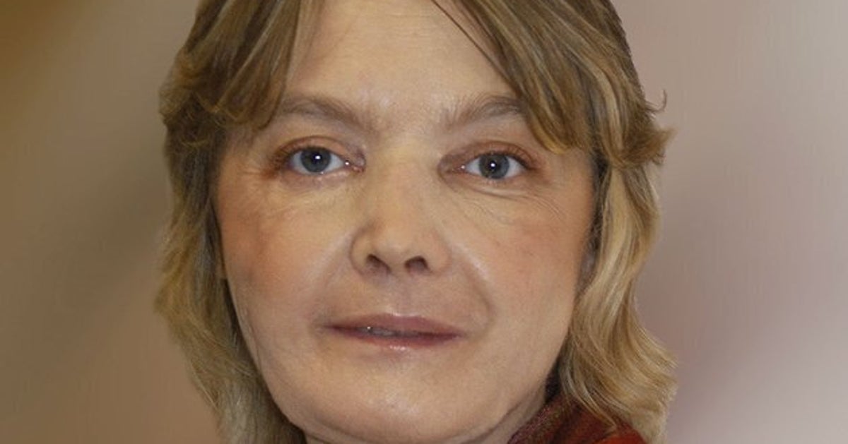 Isabelle Dinoire, First Face Transplant Recipient, Dies At 49 ...