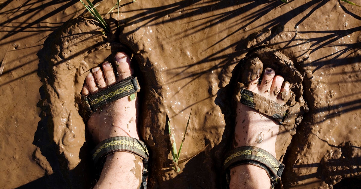 Deadly Mud-Dwelling Bacteria Melioidosis Stirs In The Northern ...