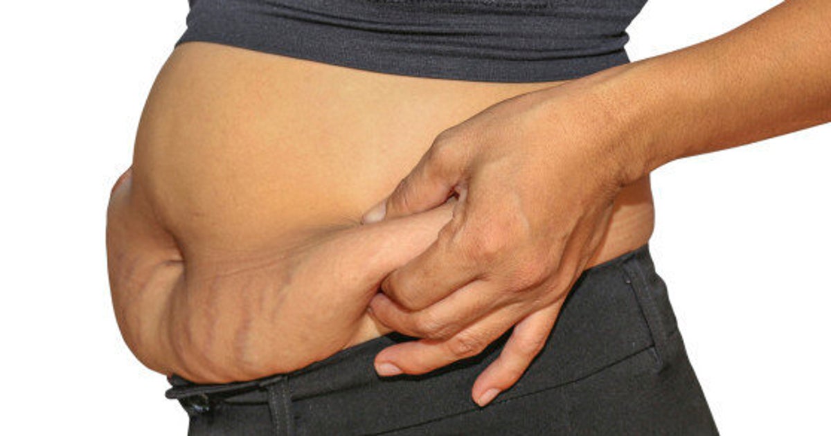 How To Get Rid Of Loose Skin After Weight Loss | HuffPost Life