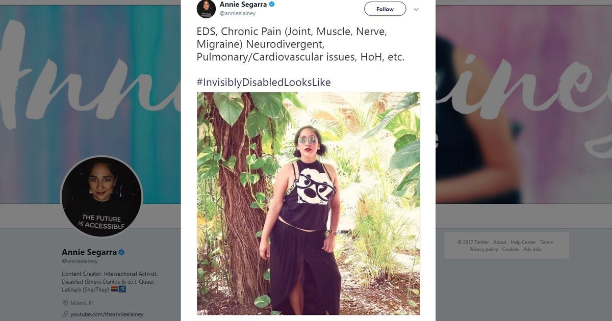 People Share Powerful Photos Of What Invisible Disabilities Look Like ...