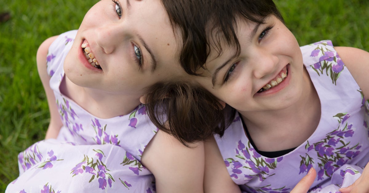 Tatiana And Krista Hogan Featured In CBC Documentary 'Inseparable ...