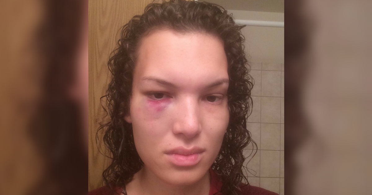 Aisha Walker Punched 'At Full Force' For Standing Up To Sexual ...