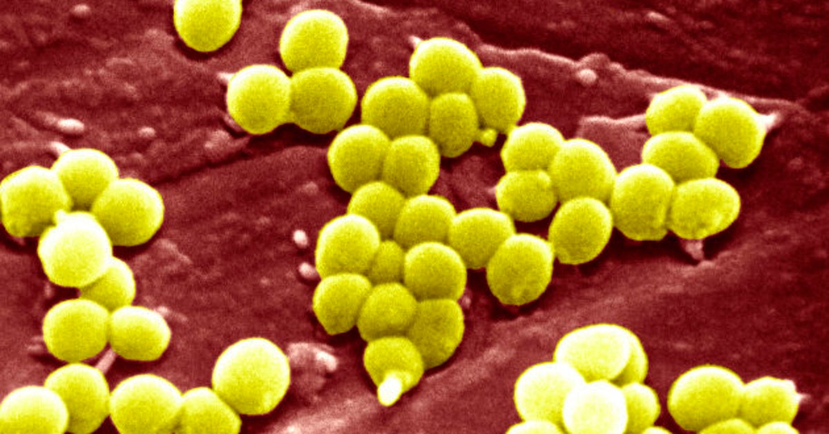 Good Hygiene Can Keep Your Normally Harmless Bacteria From Turning ...