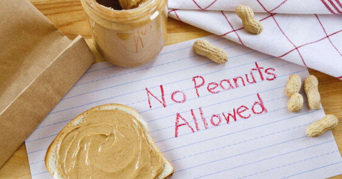 Peanut Allergies Lead To Bullying In Schools, Newfoundland Doctor Says ...