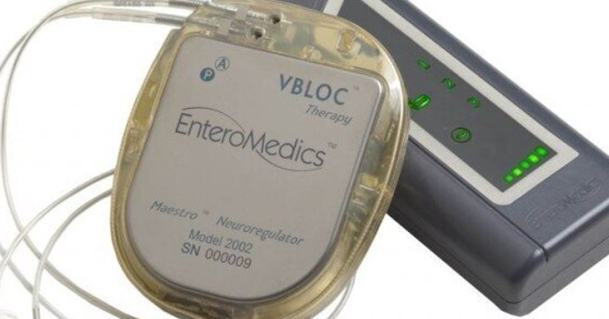 Weight Loss 'Pacemaker' Device Set To Help Obese People | HuffPost Life