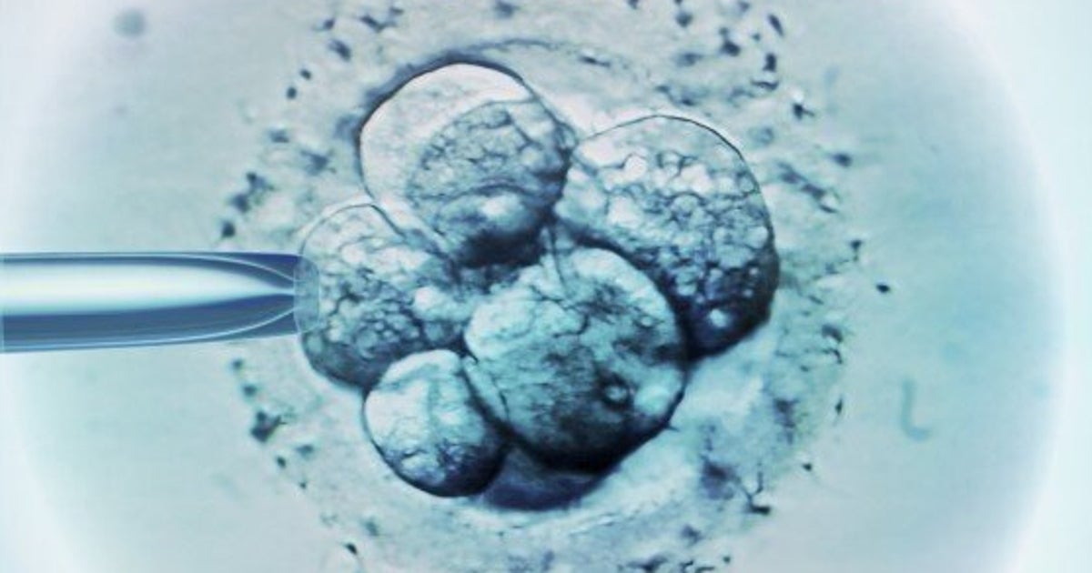 Embryo Freezing vs. Egg Freezing: What You Need To Know | HuffPost Life