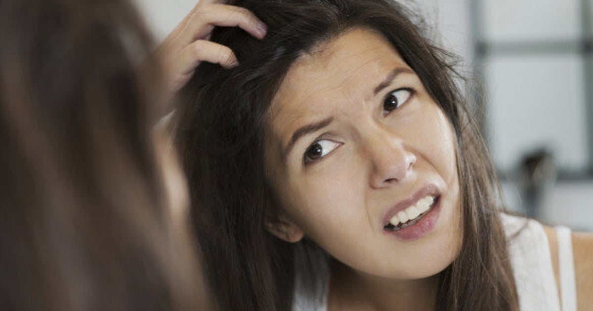 The Real Cause Of Dandruff Is Not What You Think | HuffPost Life
