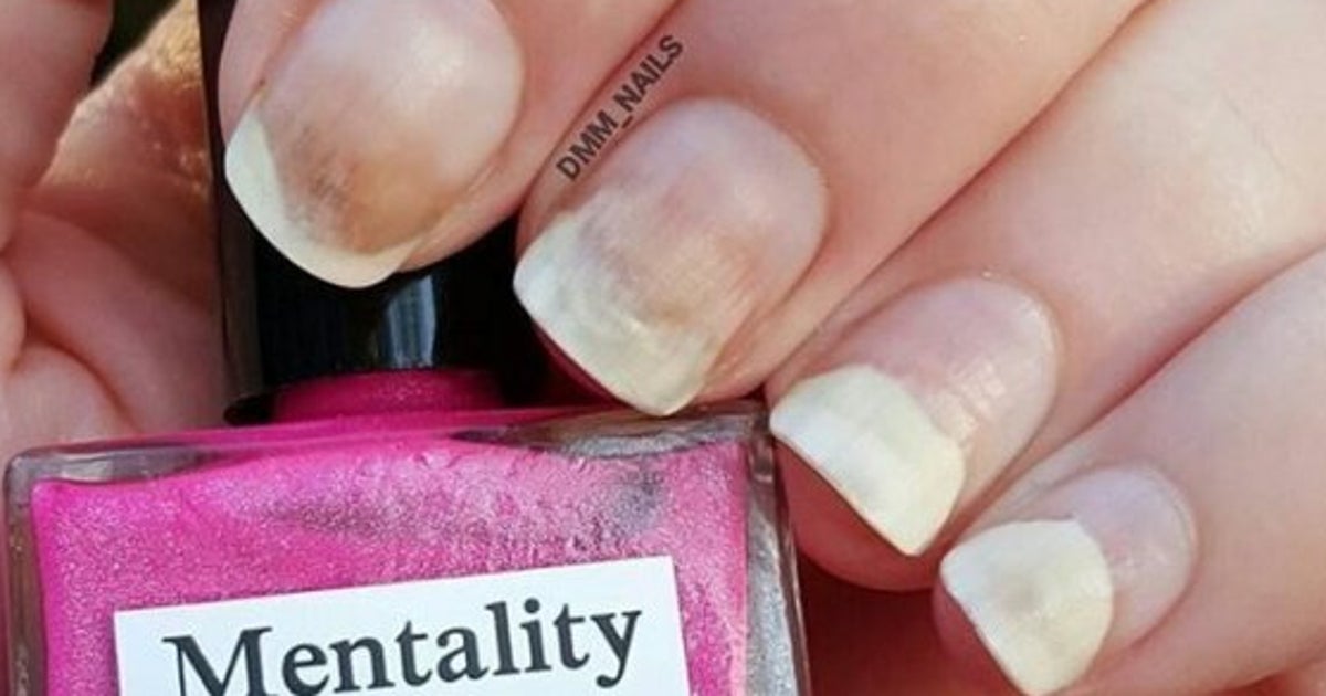 Mentality Nail Polish Under Fire For Ruining People's Nails | HuffPost ...