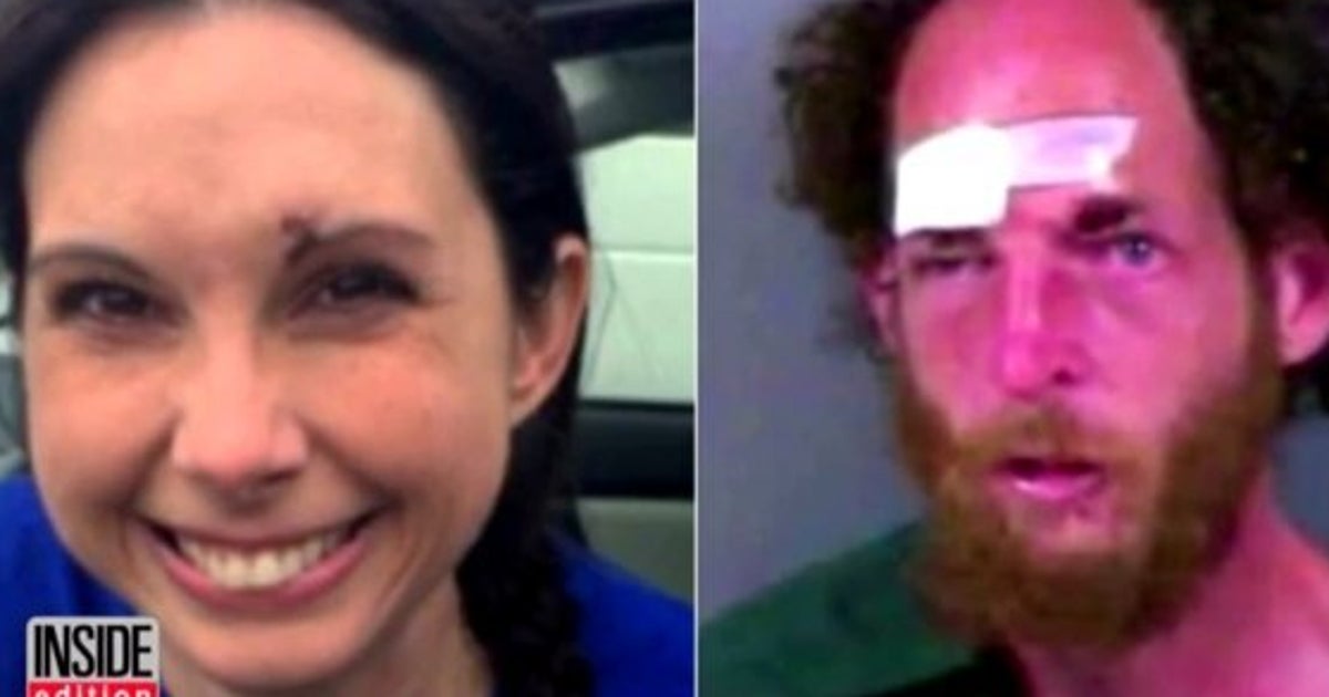 Kelly Herron, Seattle Jogger, Fights Off Attack And Attempted Rape In ...