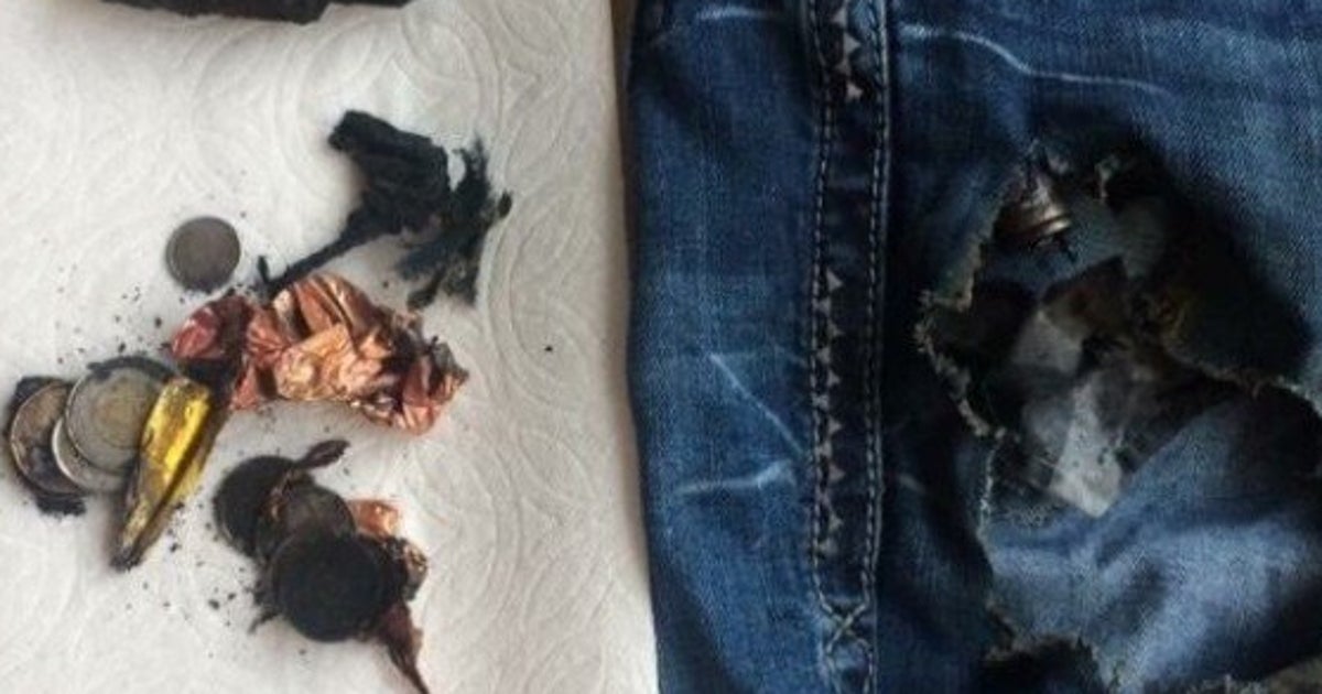 Exploding E-Cigarette Battery Severely Burns Calgarian | HuffPost Alberta