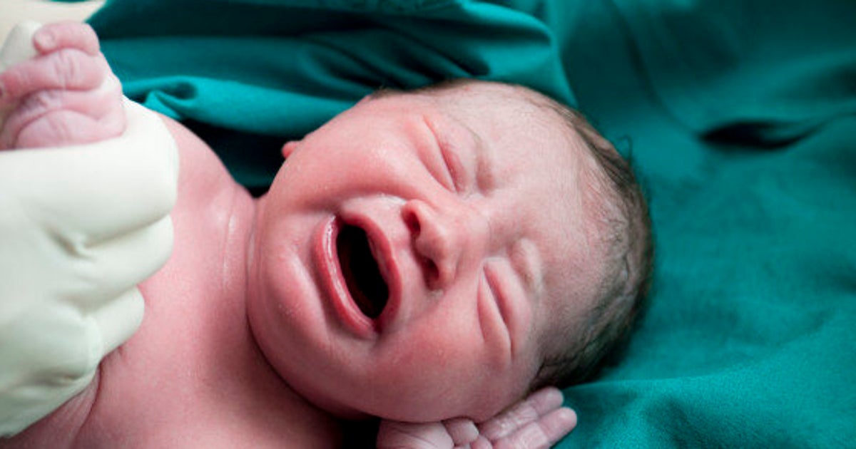 Rise In C-Sections Could Be Changing Human Evolution | HuffPost Parents