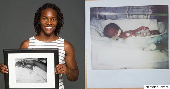 I Was Born Prematurely At 2 Pounds. Today, I'm Doing Great. | HuffPost Life