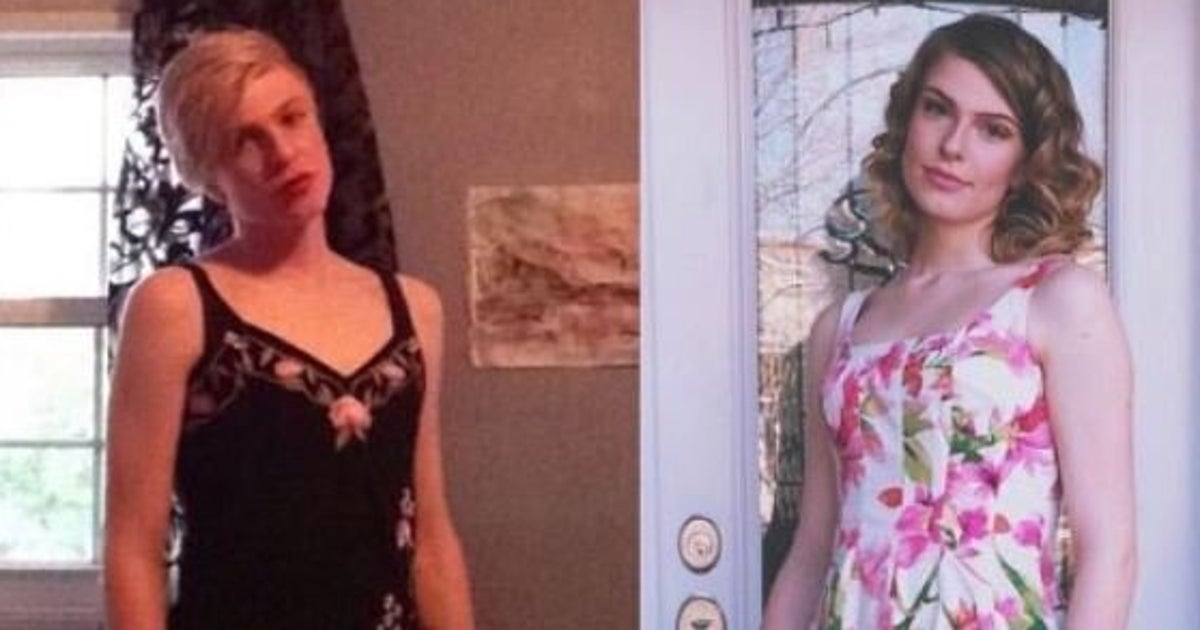 Ottawa Transgender Teen Shares Inspiring Before And After Photos ...