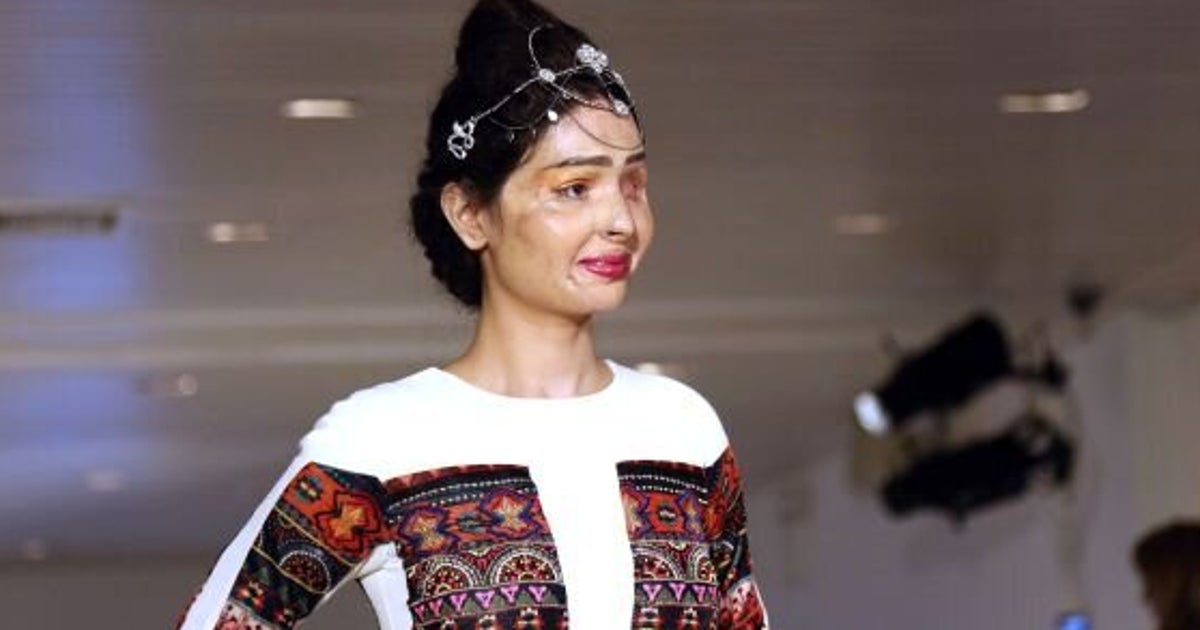 Acid Attack Survivor Reshma Qureshi Wows On The Runway At New York ...