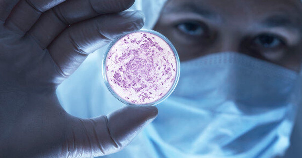 Meet Escherichia albertii, A Pathogen To Watch | HuffPost Life