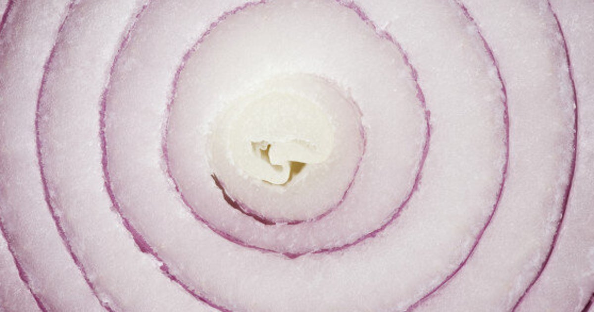 Onion Health Benefits: 15 Things You Should Know | HuffPost Life
