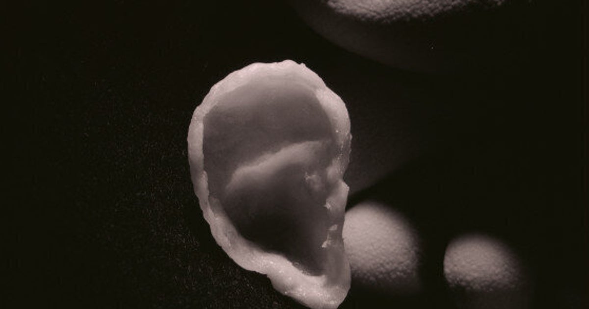 Body Parts Grown In Lab Range From Noses To Ears To Blood Vessels ...