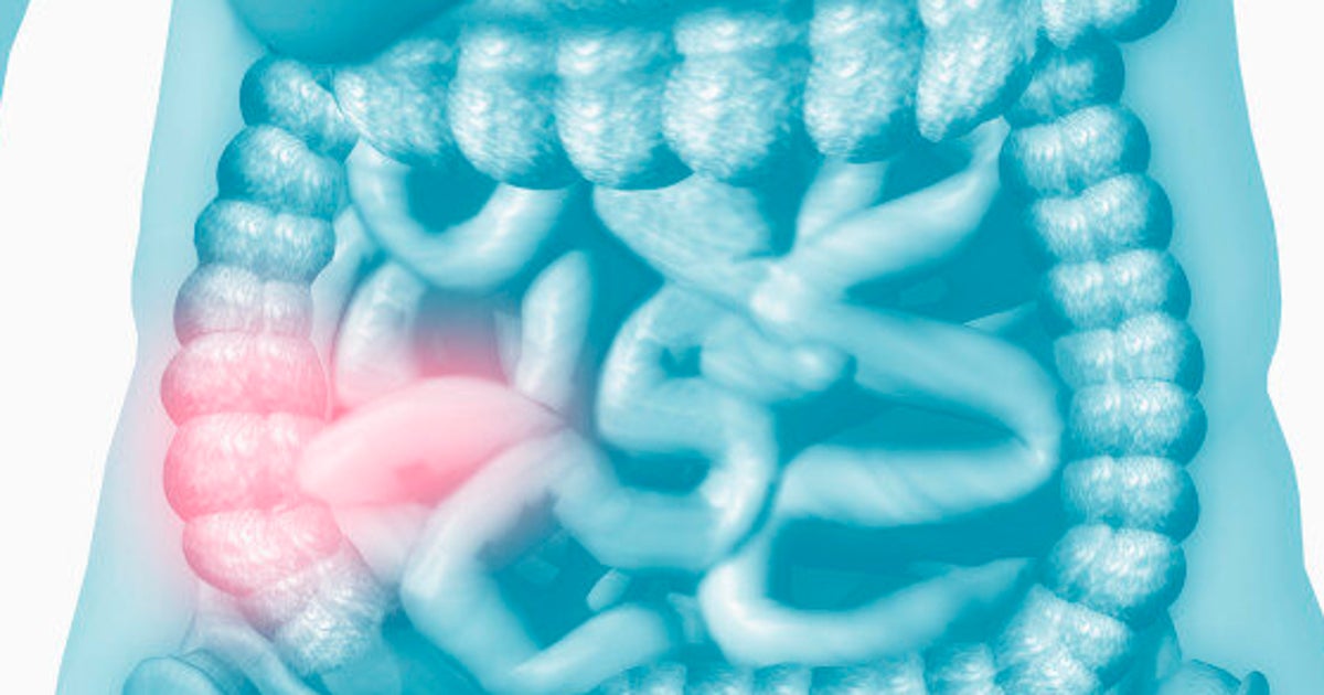 Don't Let Ulcerative Colitis Stop You From Living Life to the Fullest ...