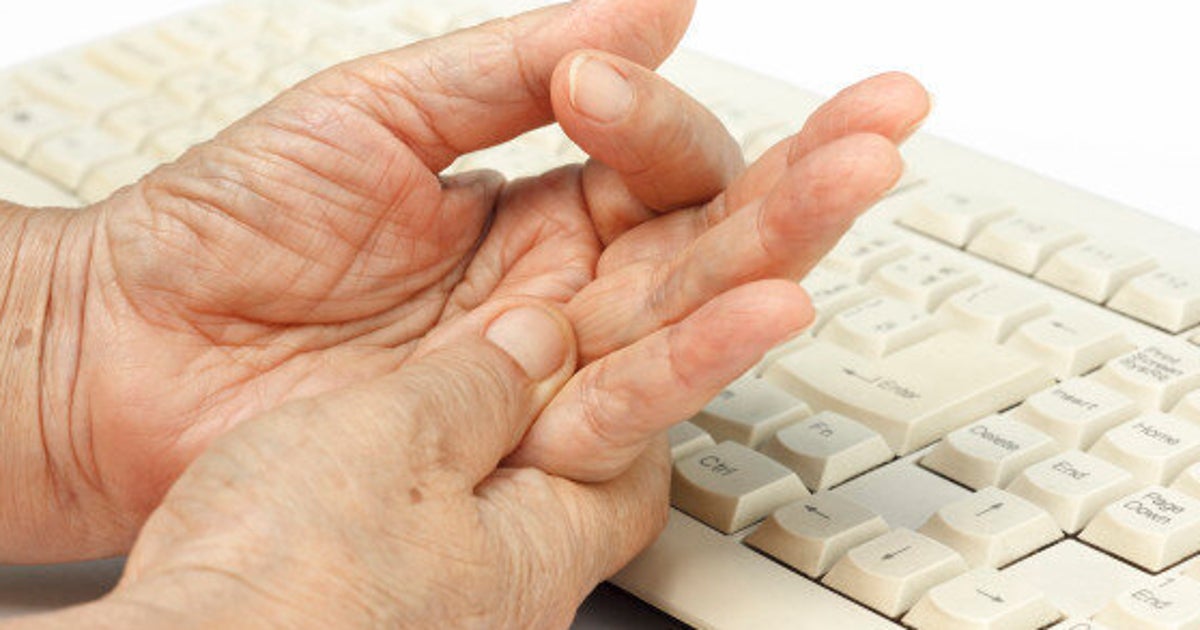 Trigger Finger Exercises: The Quick Fix | HuffPost Life