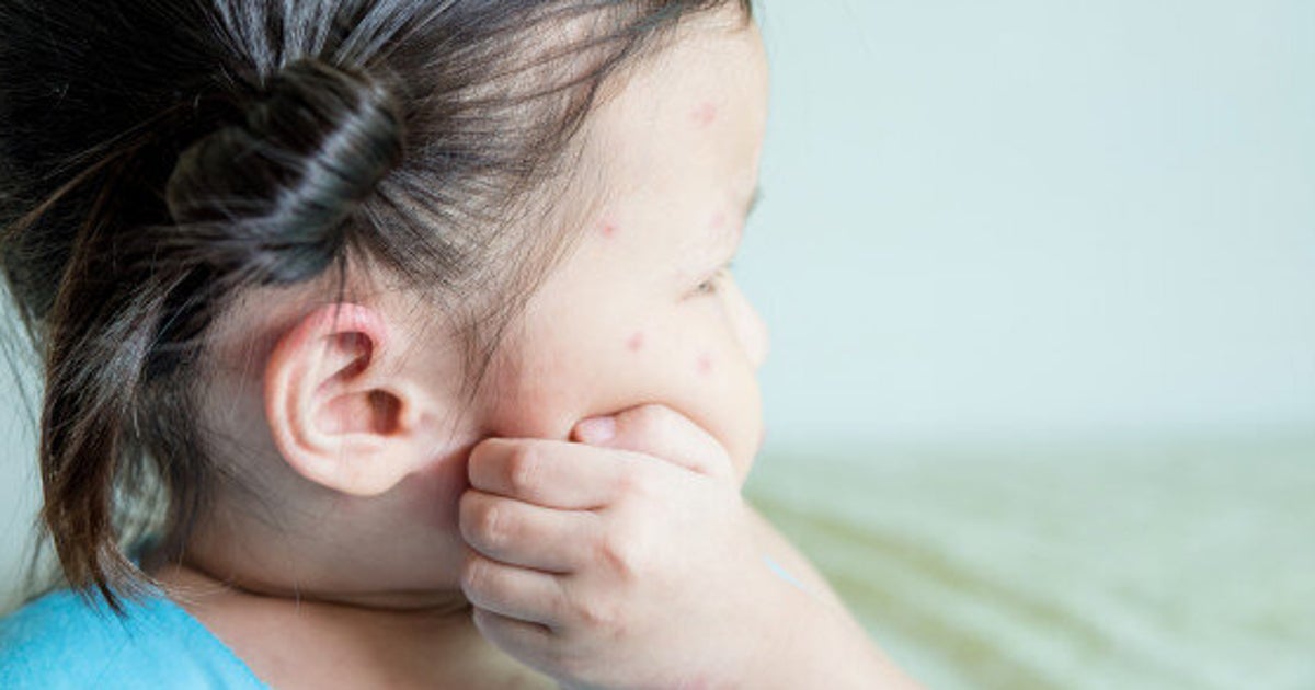 How To Protect Your Baby From Mosquito Bites | HuffPost Parents