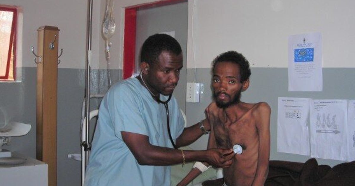 Bridging The Gap Between Tuberculosis Innovation And Access | HuffPost Life