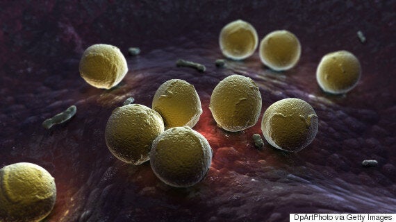 There's An End In Sight To The Horror Of Flesh-Eating Disease ...