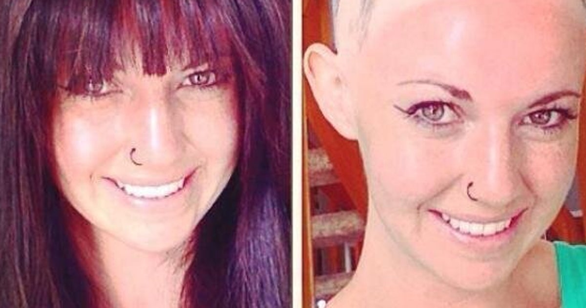 Amanda Greenough, Edmonton Ex-Cheerleader, Reveals Her Alopecia And ...