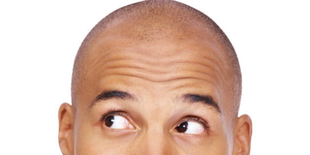Follica Touts Cure For Baldness With Breakthrough Technique | HuffPost Life