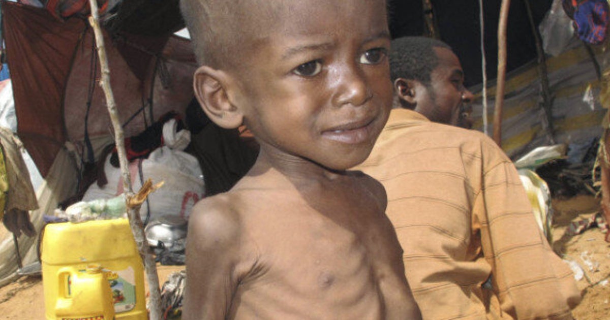 Hunger: The Silent Killer Affecting Half a Billion | HuffPost News