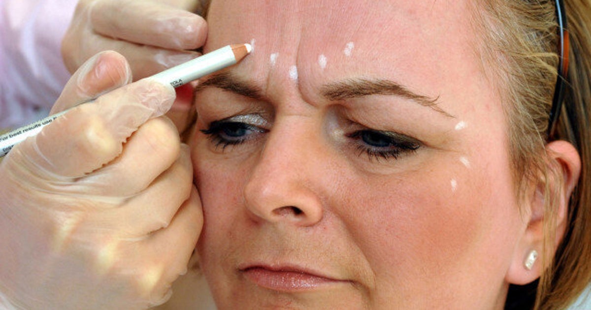 No Botox for Me, Thanks | HuffPost Life