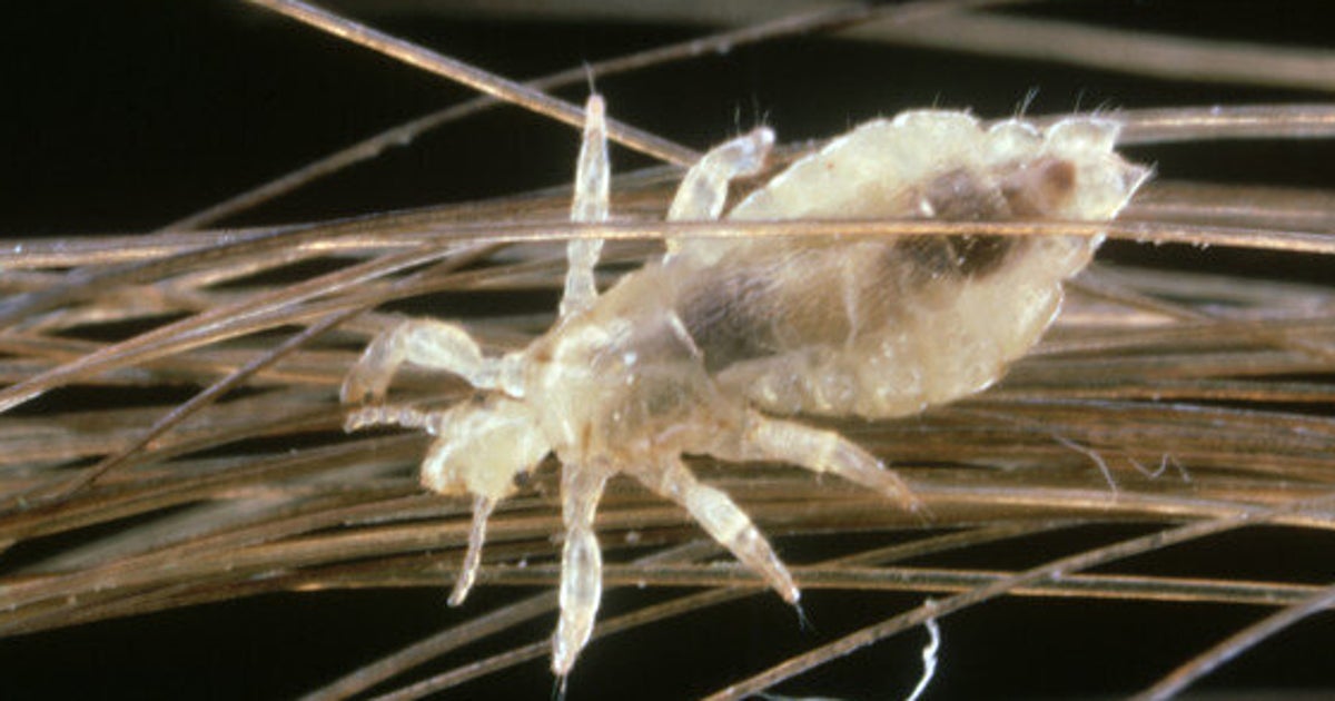 Lice. Not Nice. | HuffPost British Columbia
