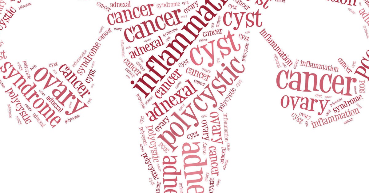 Could You Be One of the 3.5million British Women Suffering With PCOS ...