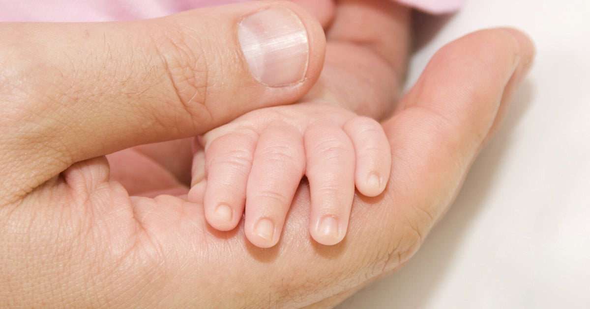 Baby Hope Becomes World's Youngest Organ Donor After Living For Just 74 ...