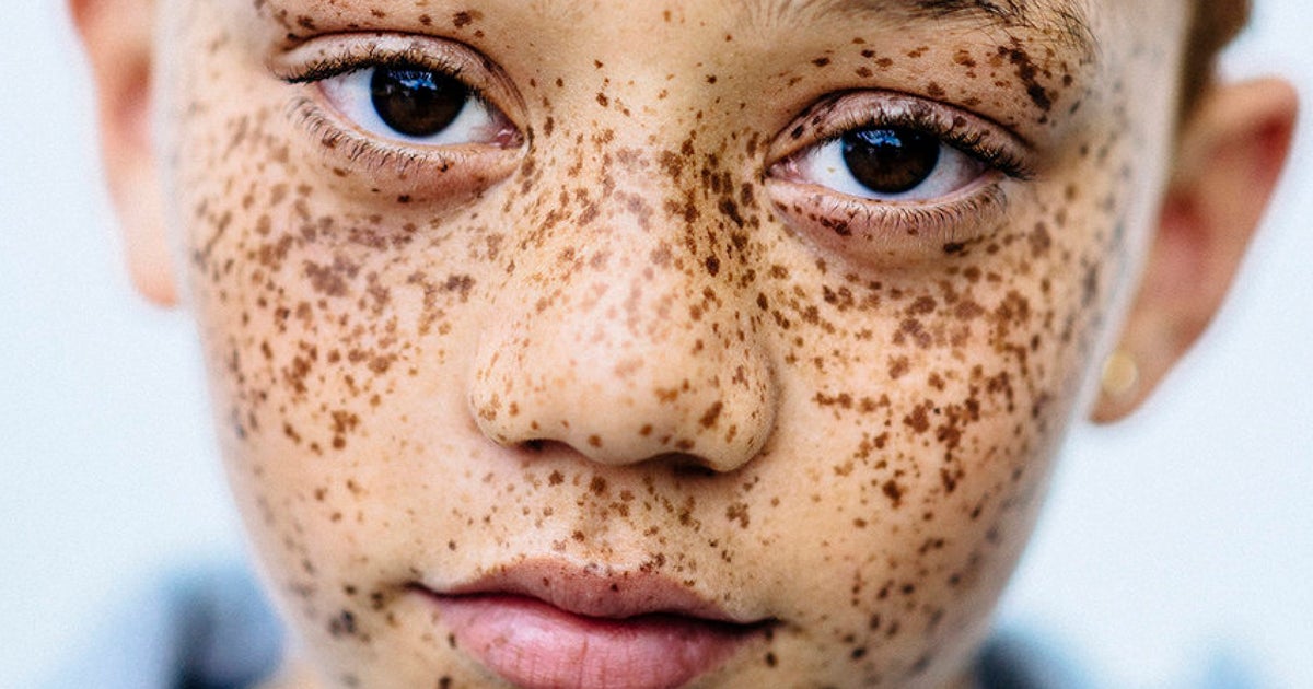 Photographer Explores The Beautiful Diversity Of Redheads Of Colour ...