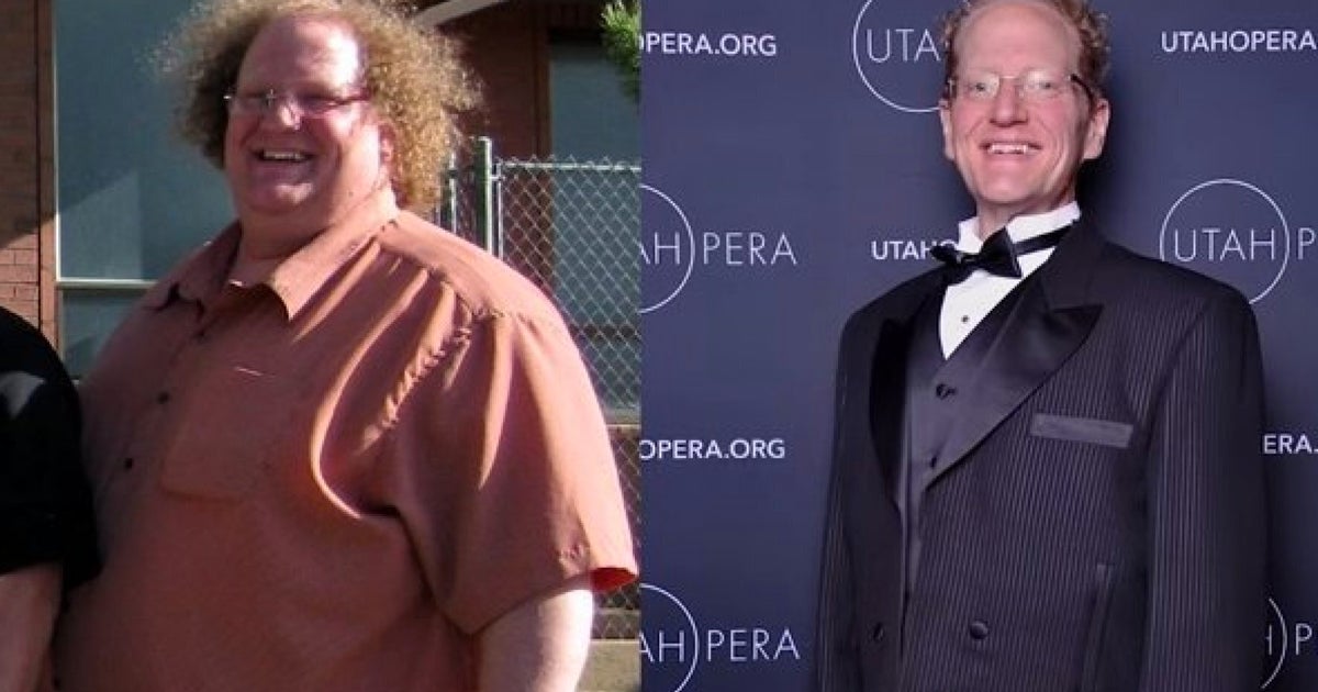 Obese Man Who Dropped 300lbs Reveals Incredible Weight Loss ...