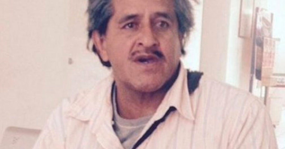 Largest Penis In The World Is Huge Headache For Roberto Esquivel ...